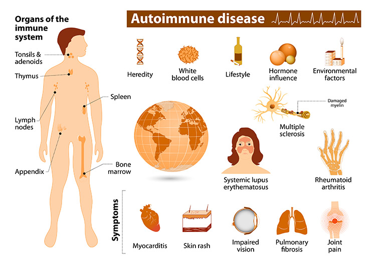 Are autoimmune diseases related to gut health?