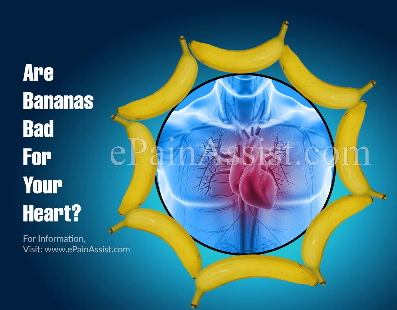 Are bananas bad for your arteries?