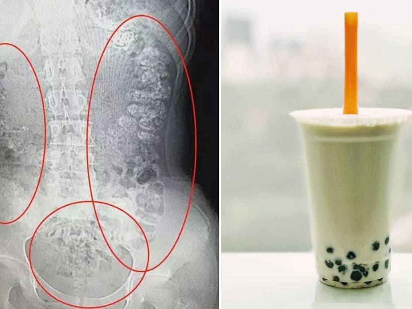 Are boba pearls bad for you?