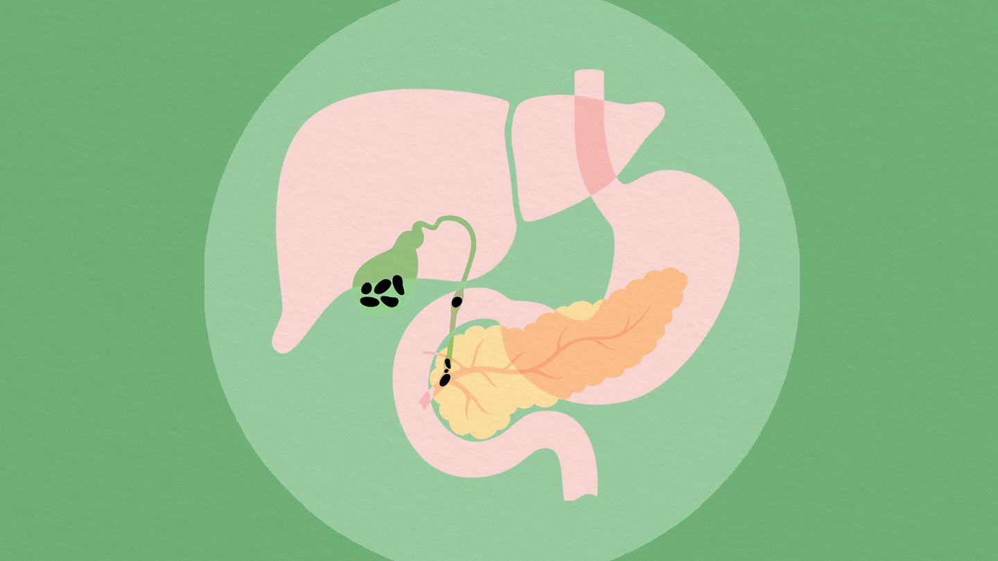 Can a fart hurt your stomach?