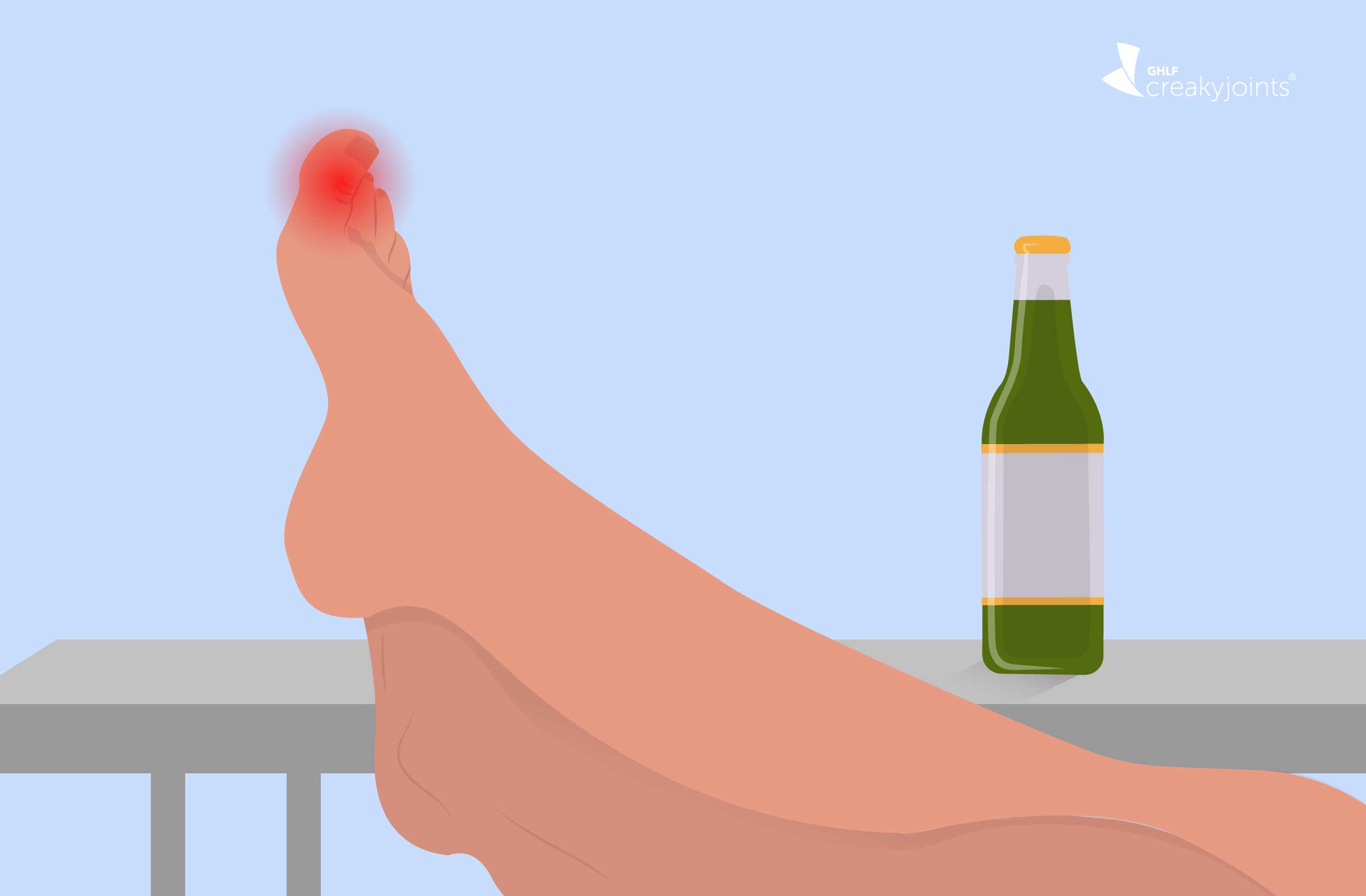 Can alcohol cause gout?