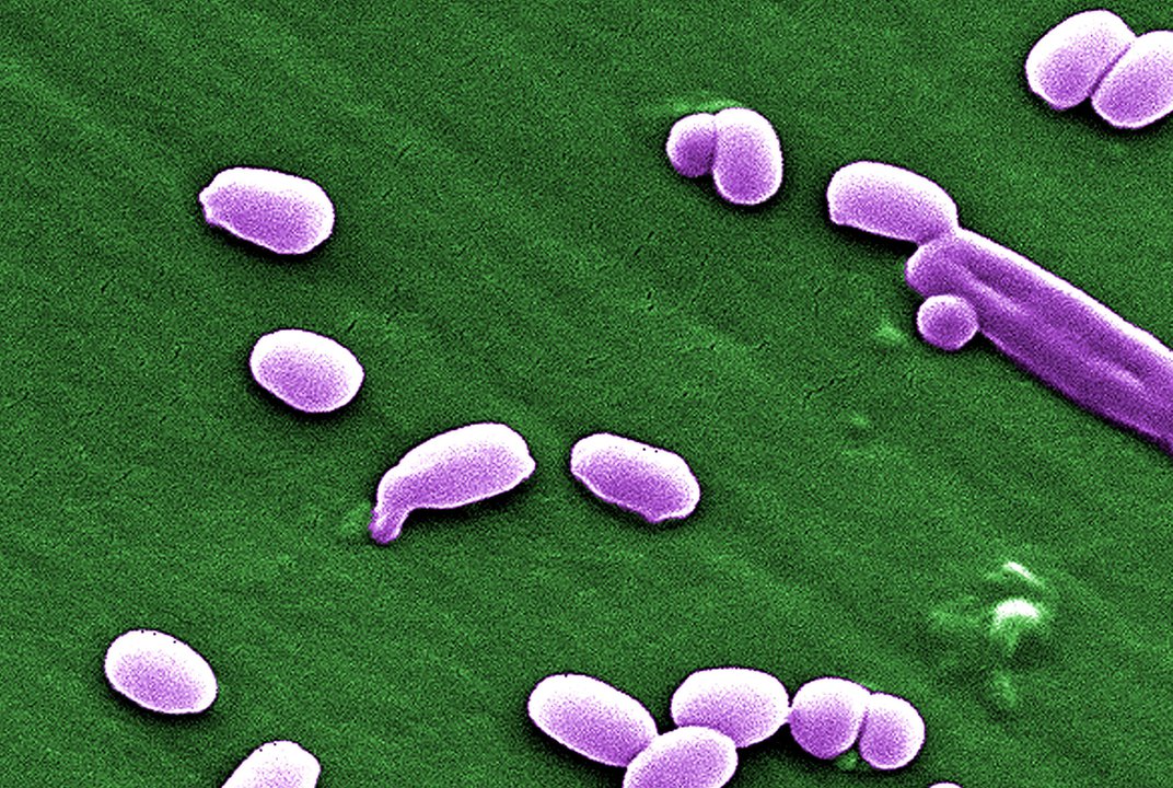 Can bacteria survive 300 degrees?