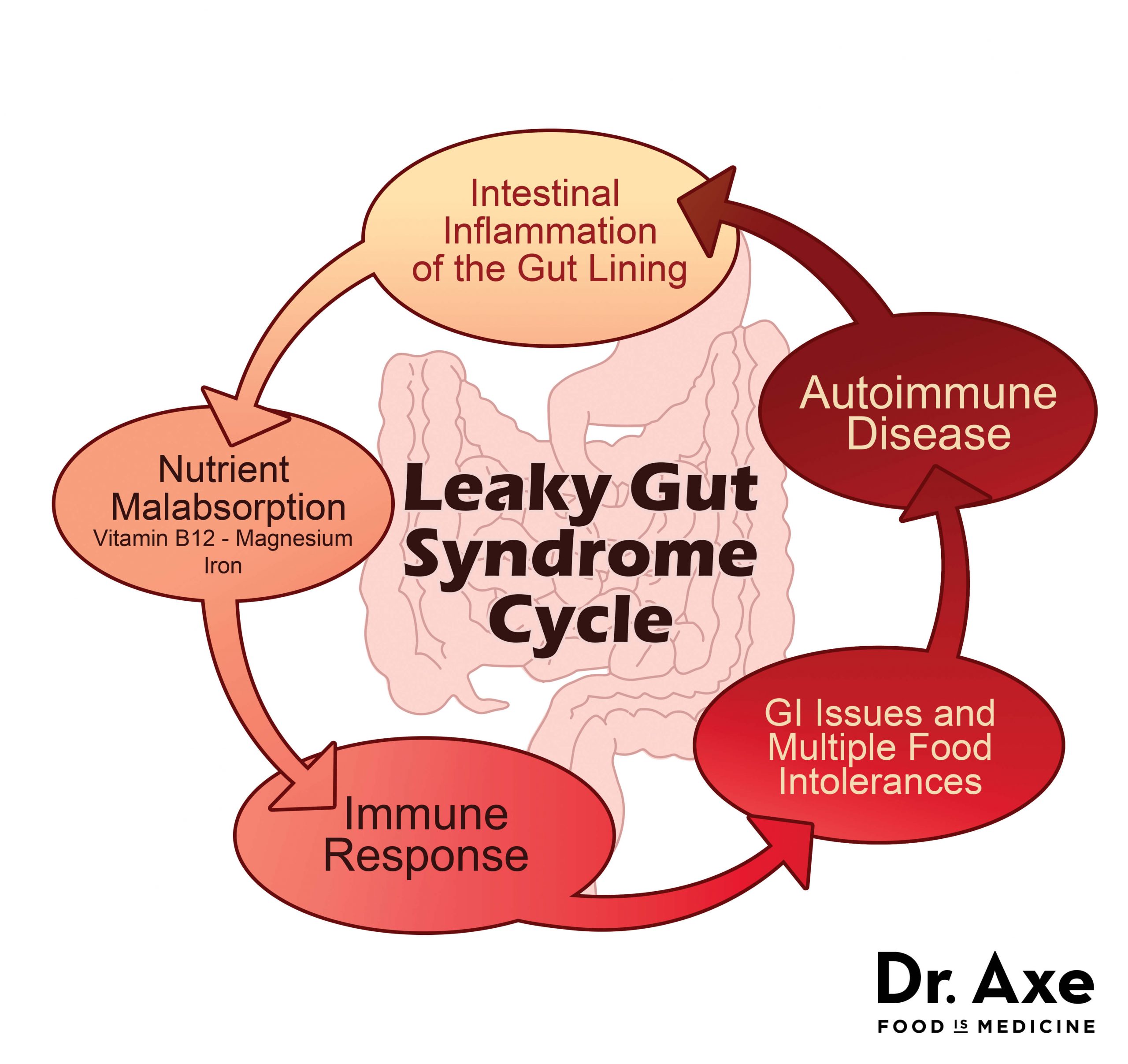 Can bone broth cause leaky gut?