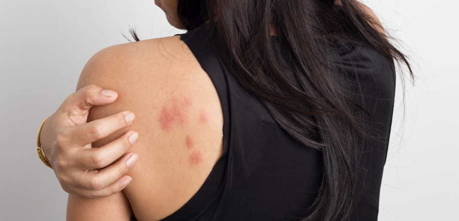 Can collagen give you a rash?