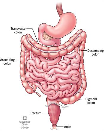 Can constipation cause inflammation of the colon?