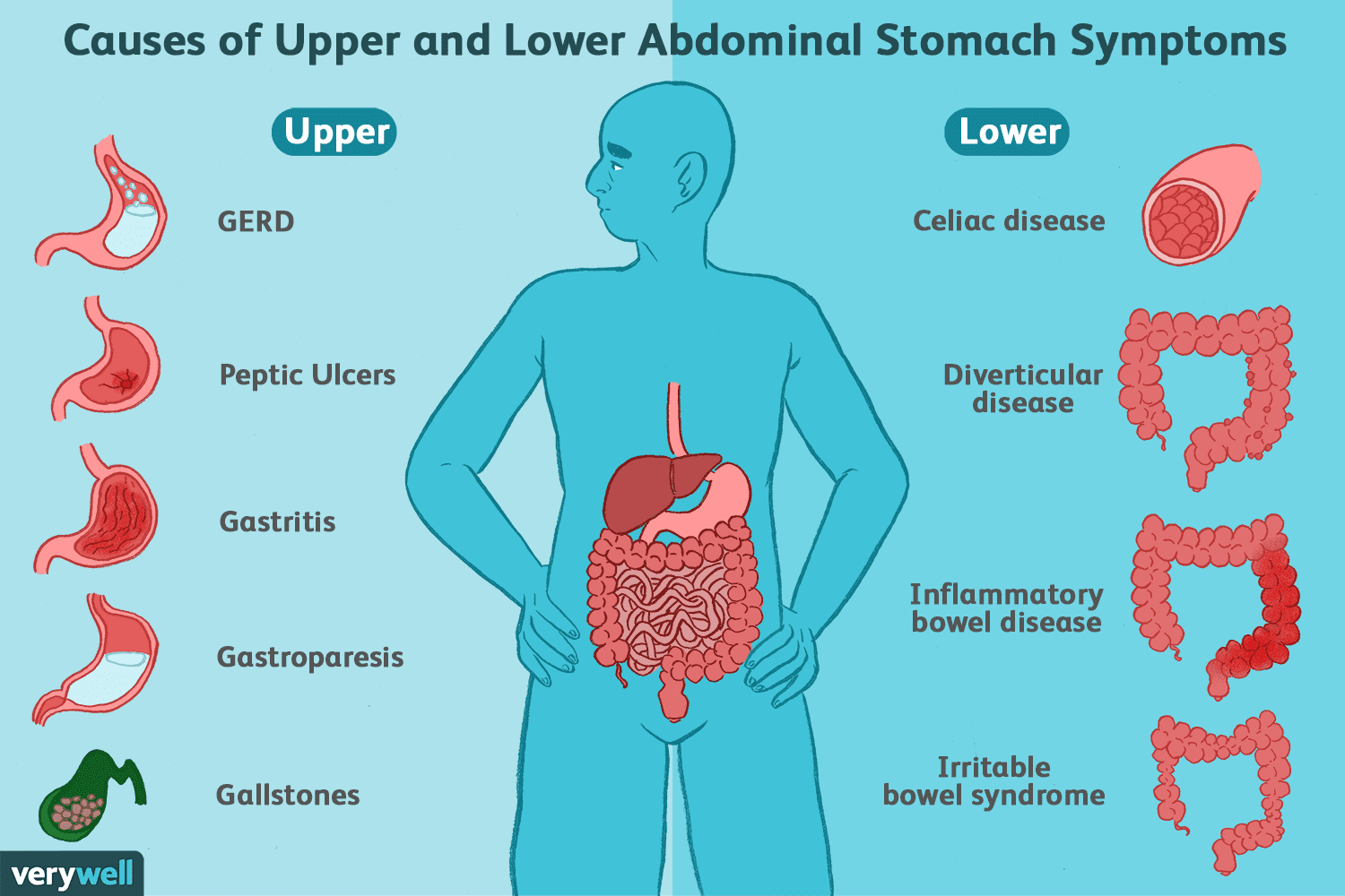 Can constipation cause inflammation?