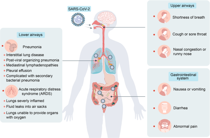 Can Covid start with upset stomach?