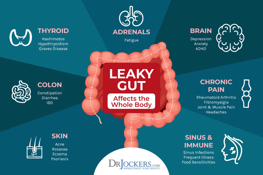 Can fasting repair leaky gut?
