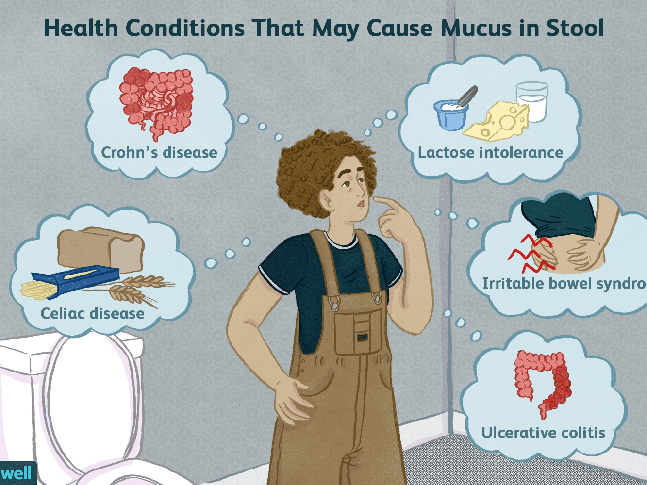 Can IBS cause mucus in stool?