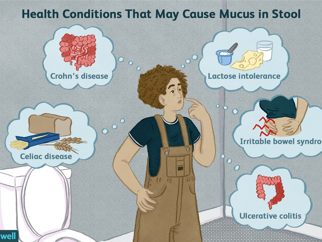 Can IBS cause white mucus in stool?