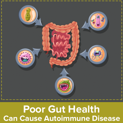 Can poor gut health cause autoimmune disease?