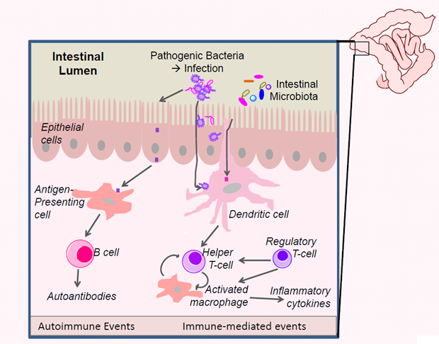 Can probiotics make autoimmune disease worse?