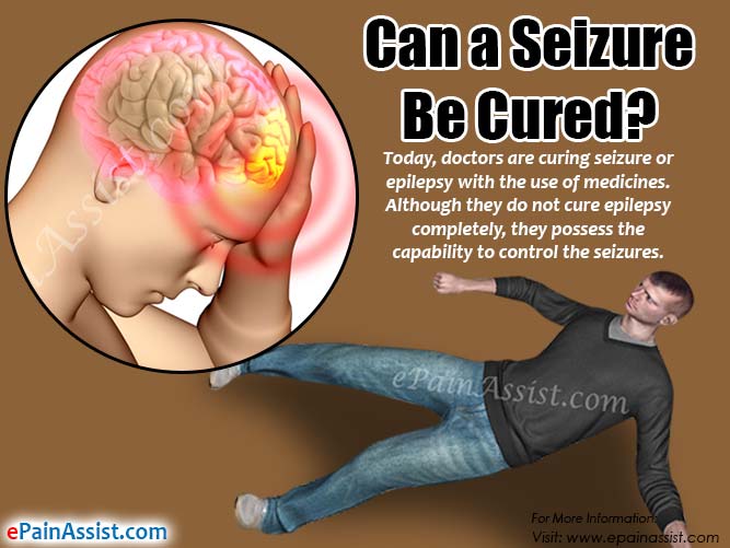 Can Sezuires be cured?