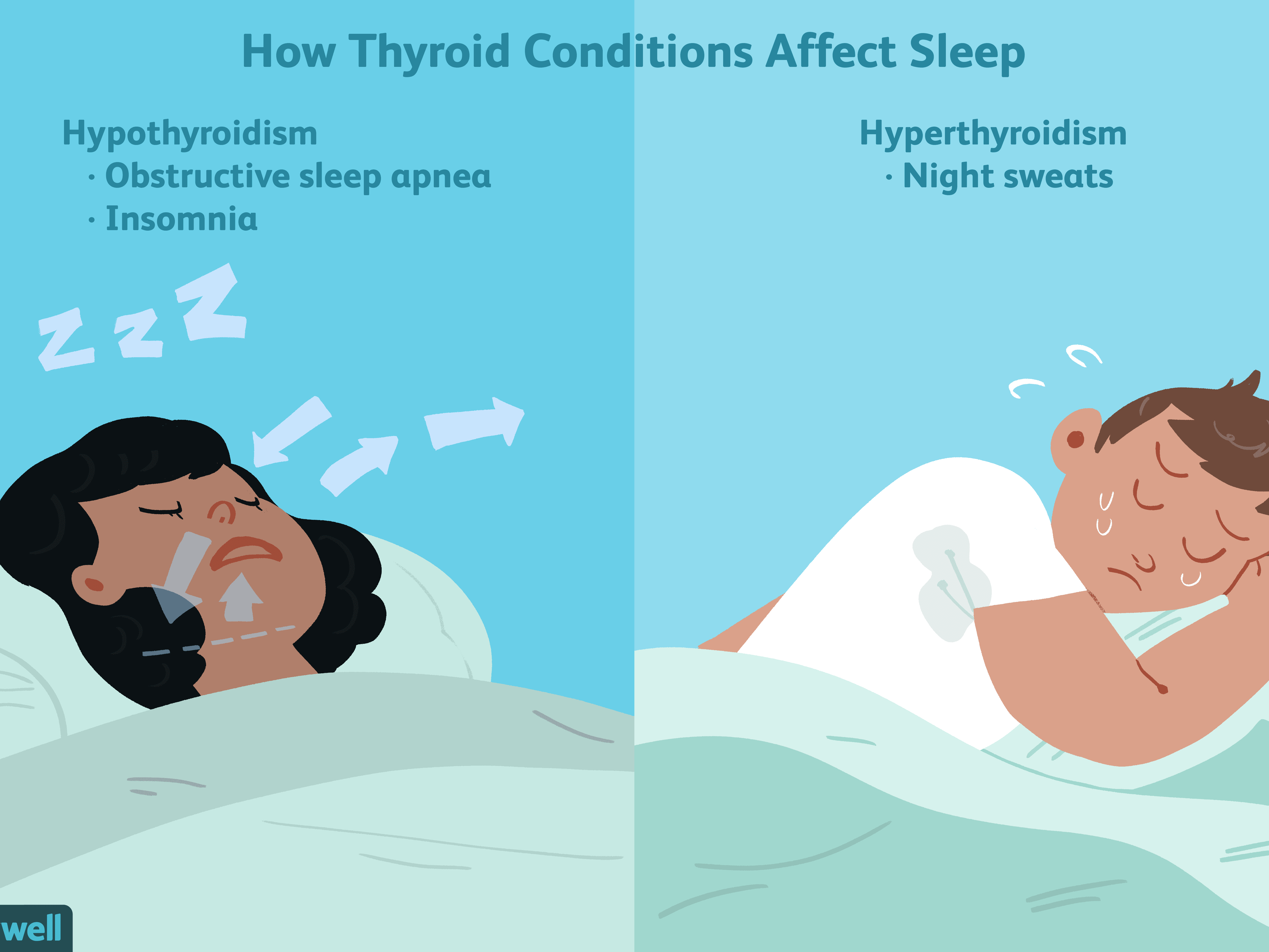 Can thyroid problems start suddenly?