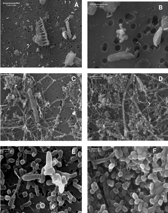 Can viruses and bacteria survive freezing?