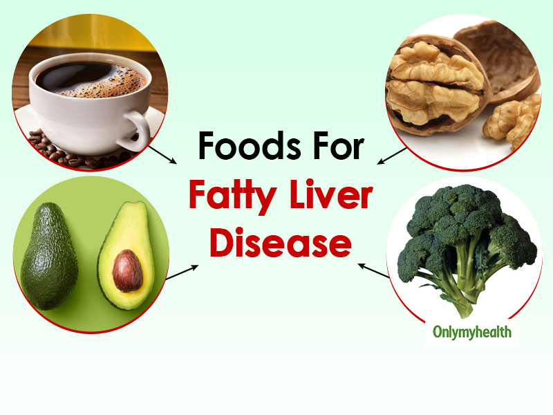 Can you drink tea if you have fatty liver?
