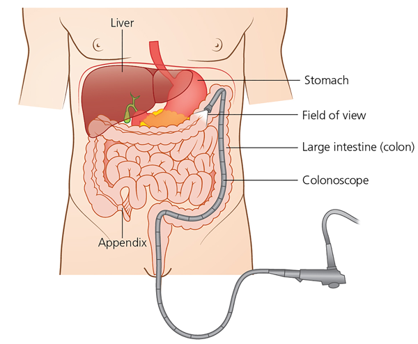 Can you get a boner during a colonoscopy?