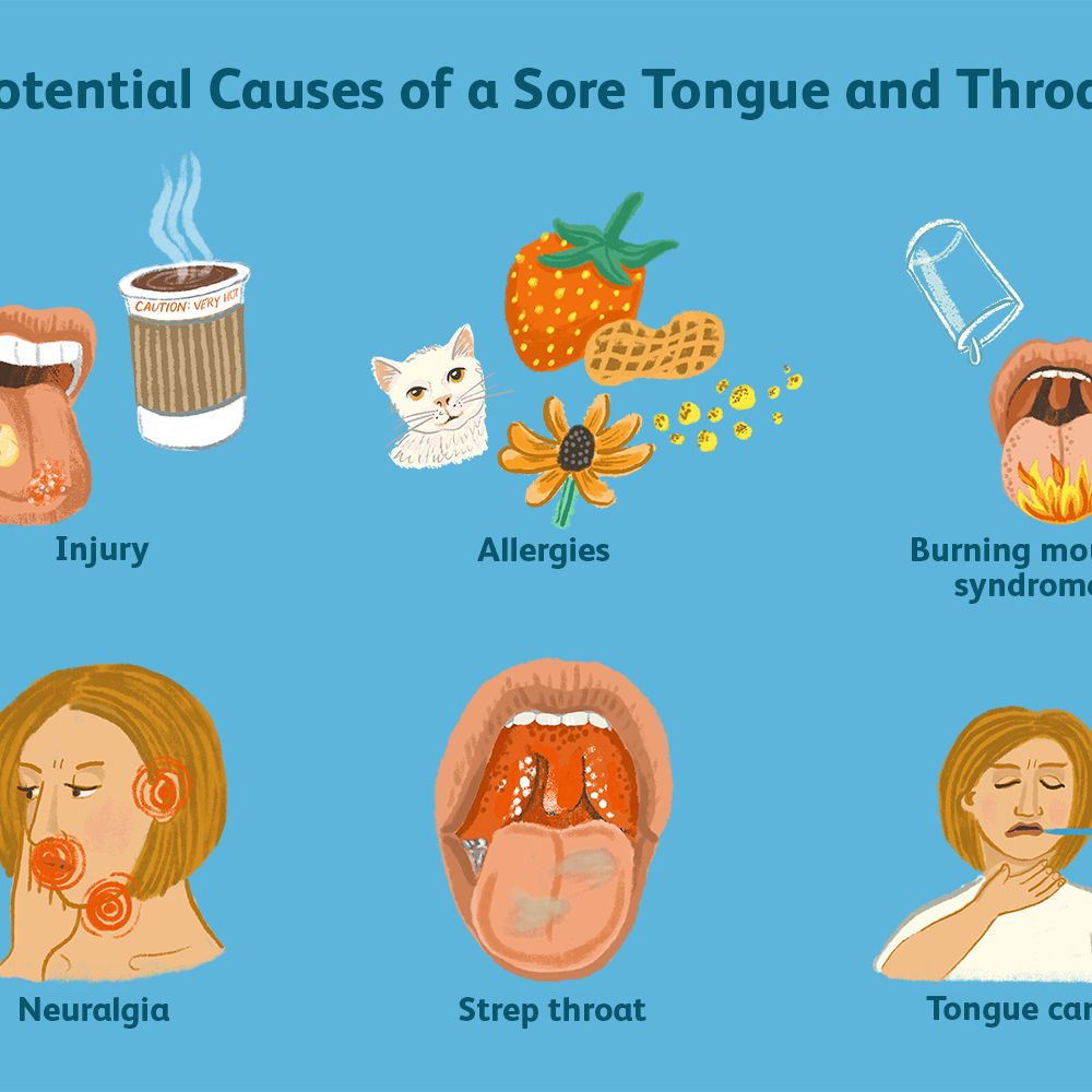 Can you get a sore throat from eating?