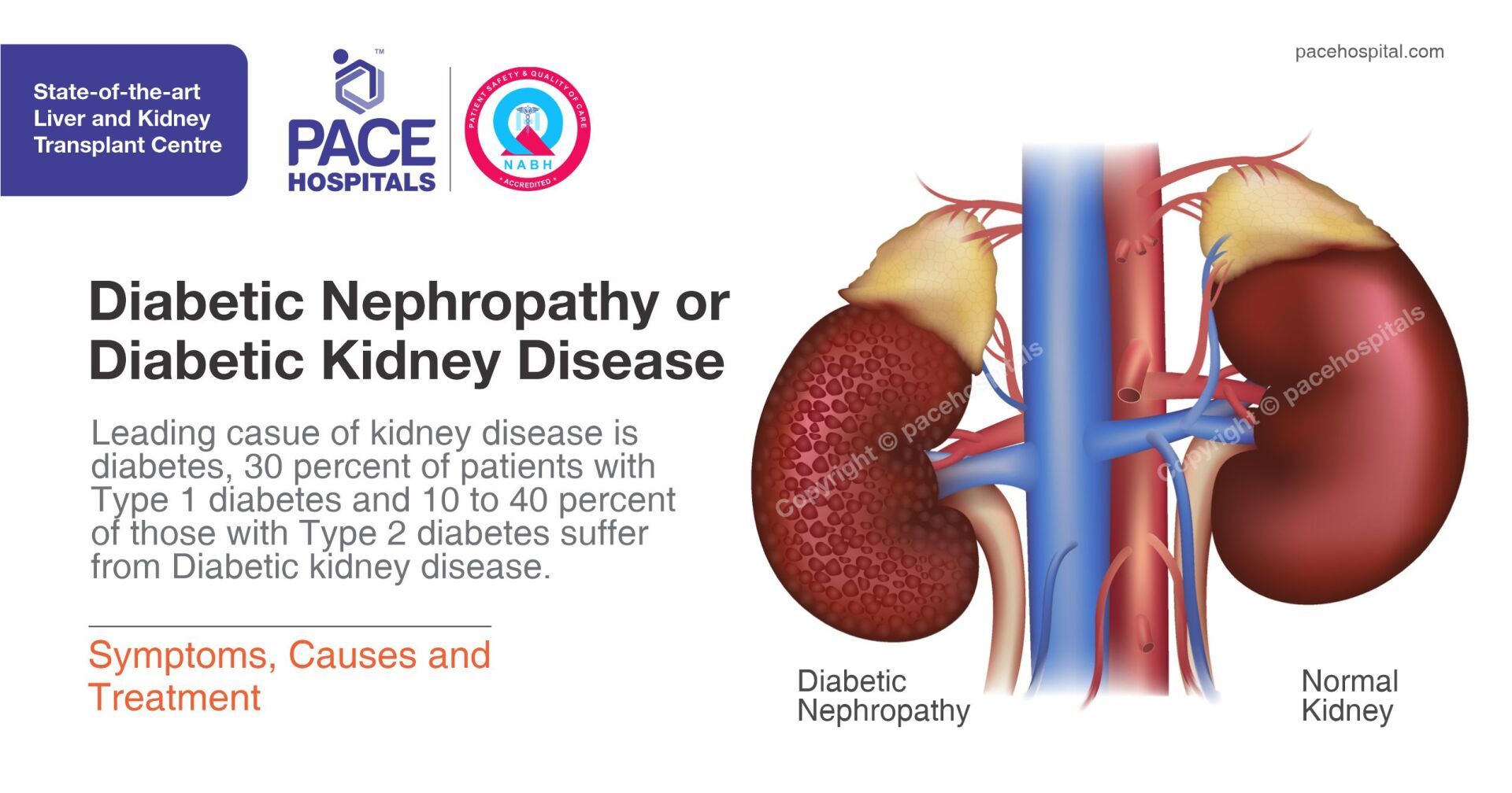 Can you stop diabetic nephropathy?