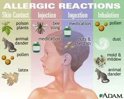 Can you suddenly become allergic to something you weren't before?