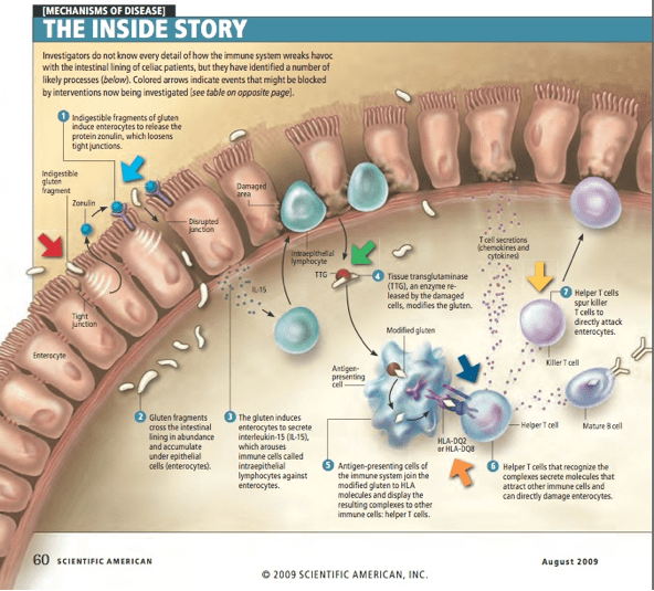 Do lectins cause a leaky gut?