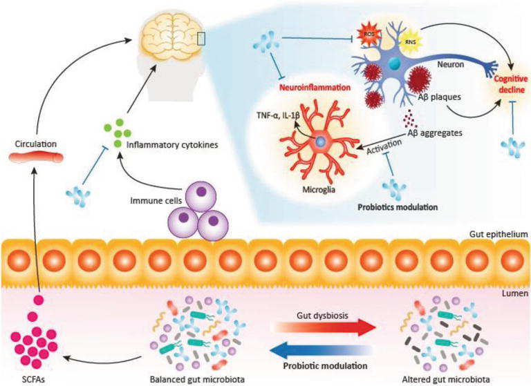 Do probiotics prevent Alzheimer's?