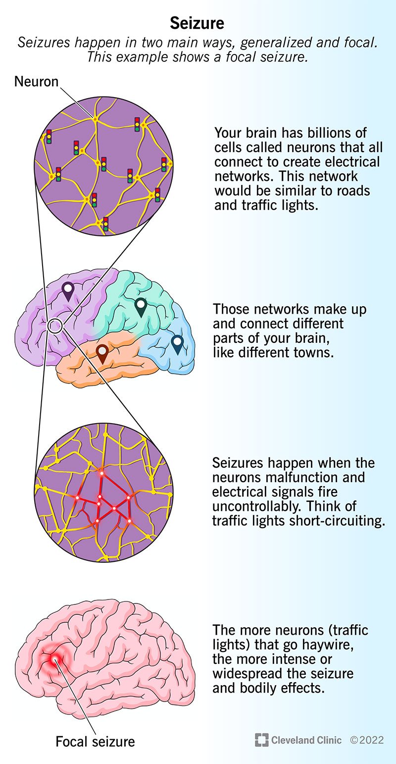 Do seizures cause permanent damage?