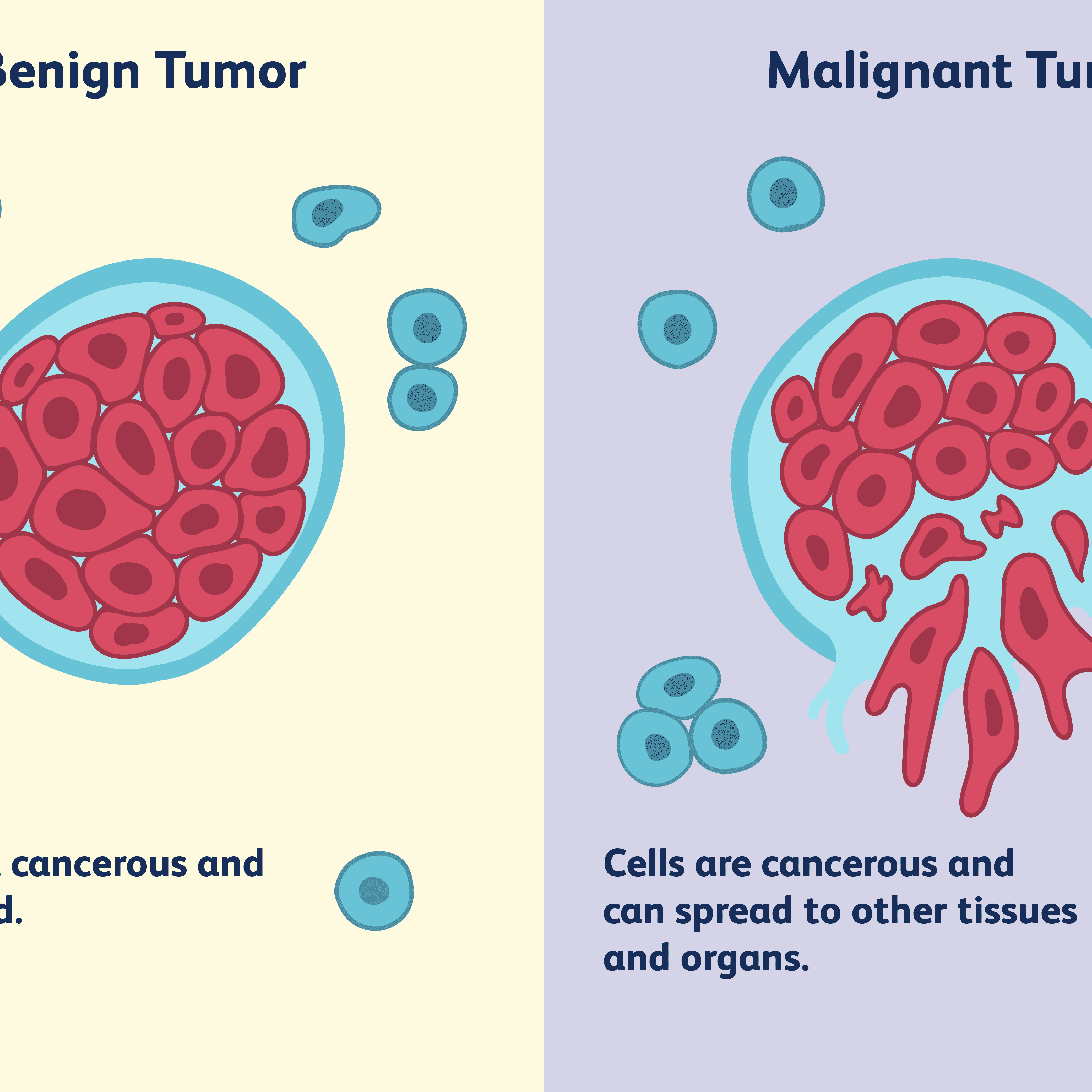 Does a lump mean tumor?