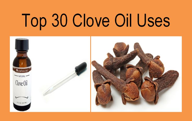 Does clove oil help with gas and bloating?