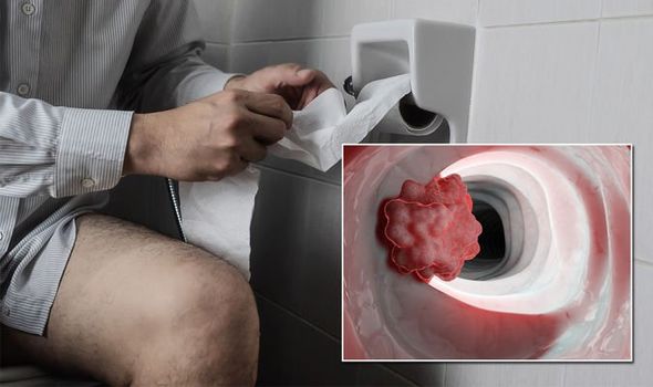 Does colon cancer cause bloody mucus?