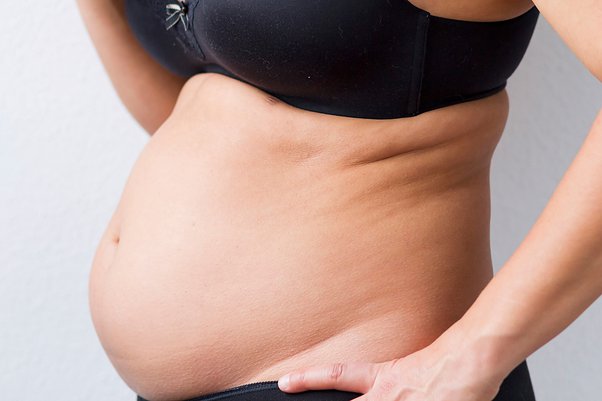 Does diabetes make your belly bigger?