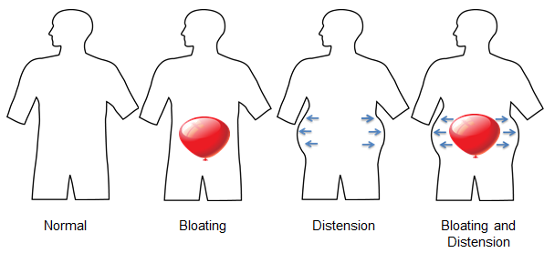 Does gas mean bloating?