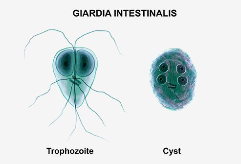 Does Giardia cause smelly gas?