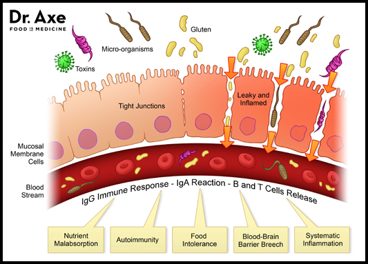 Does gluten damage the gut?