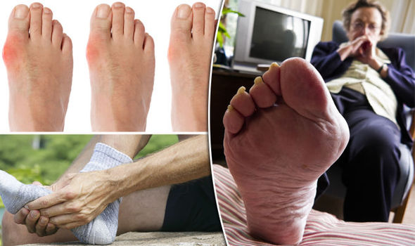 Does gout get worse when you stop drinking?