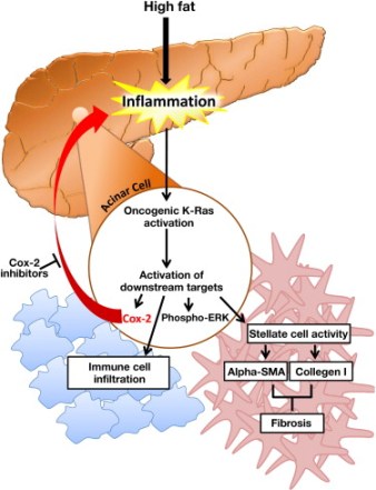 Does high-fat diet cause pancreatic cancer?