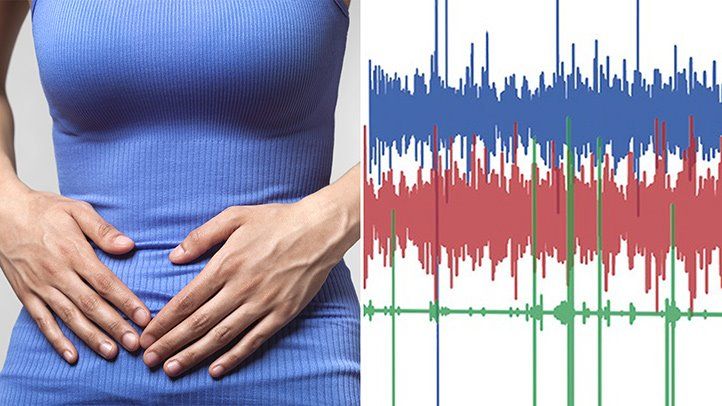 Does IBS cause loud stomach noises?