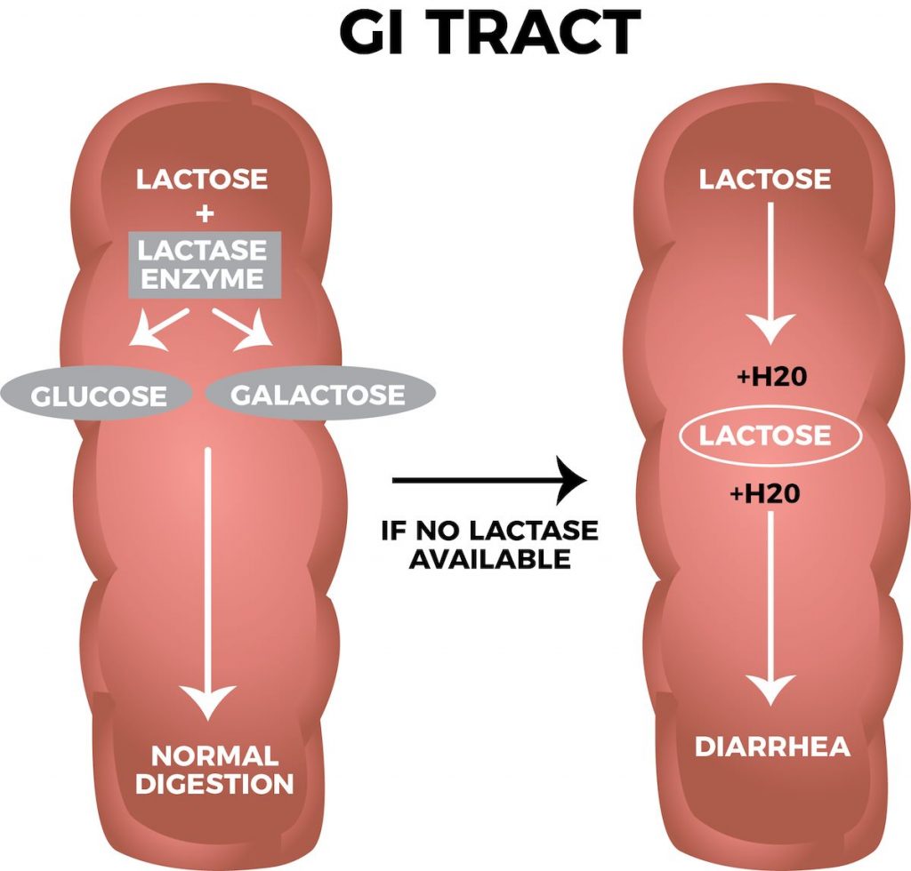 Does lactose intolerance make your farts smell?