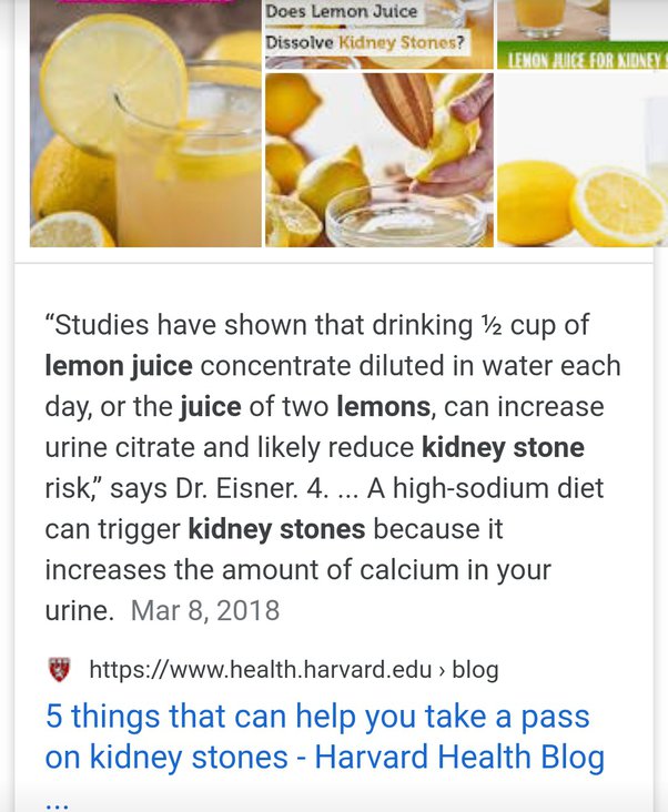 Does lemon juice dissolve bladder stones?