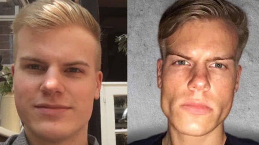 Does losing face fat make your jawline better?