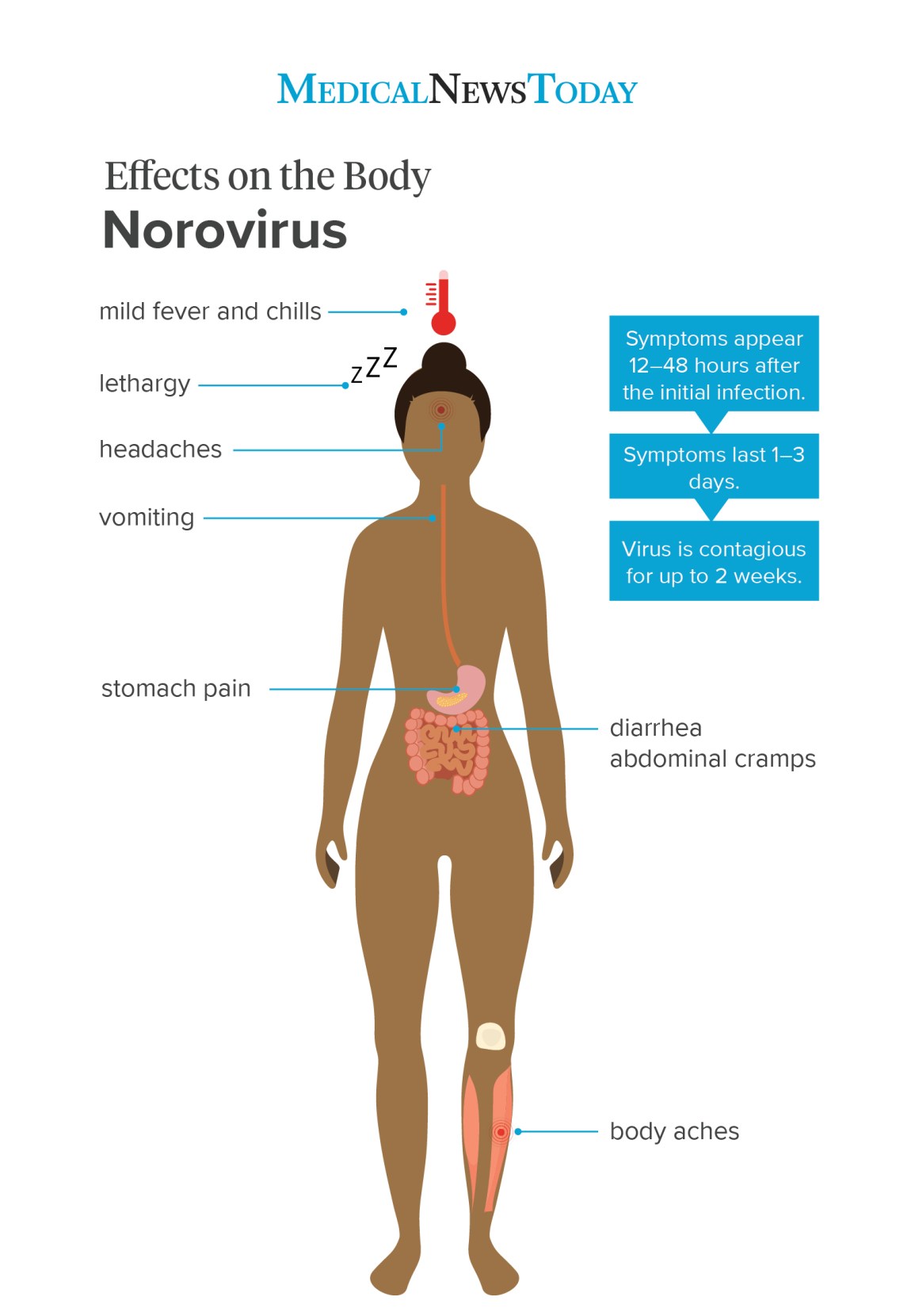 Does Norovirus cause mucus in stool?