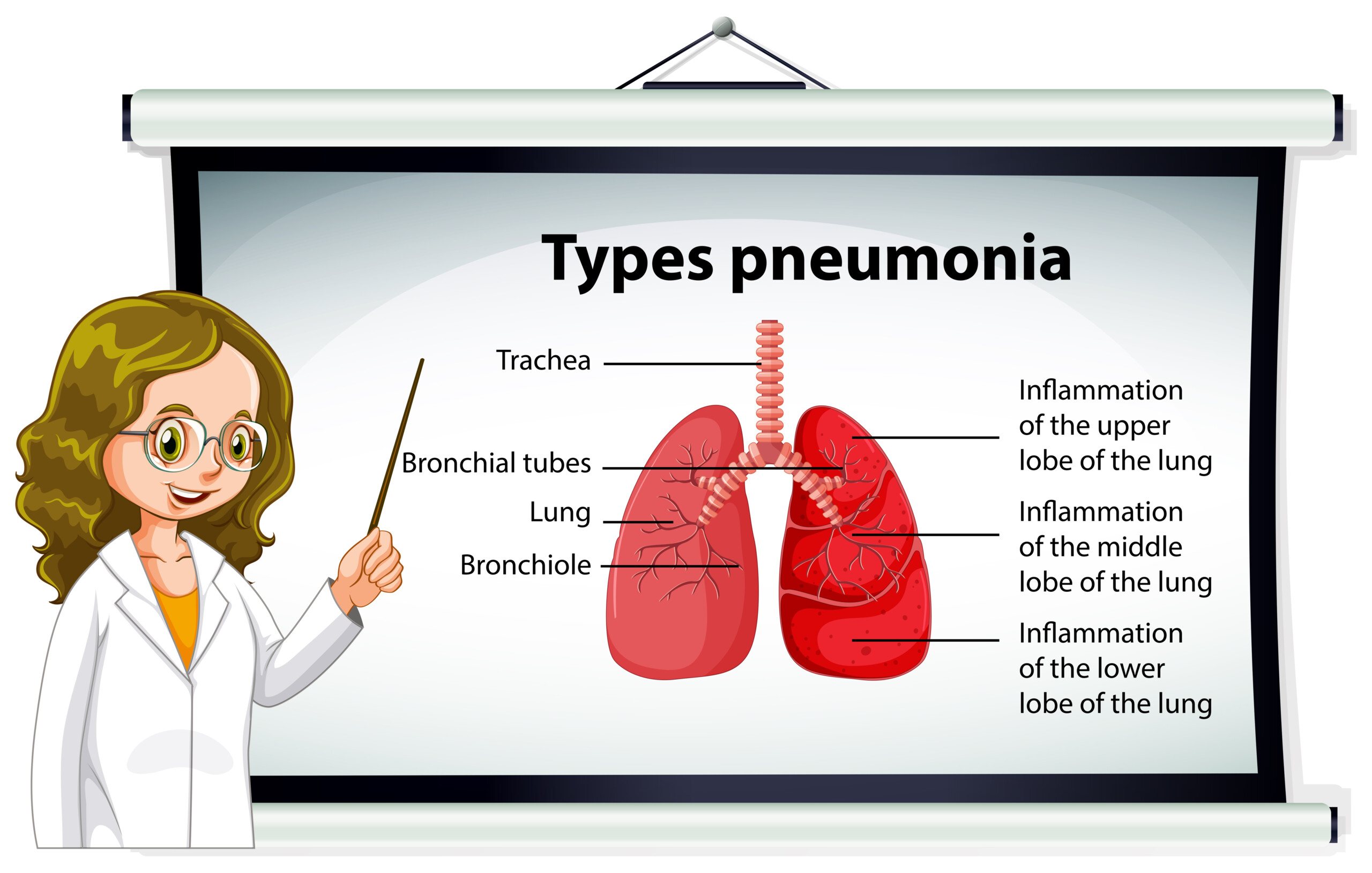 Does pneumonia go away on its own?
