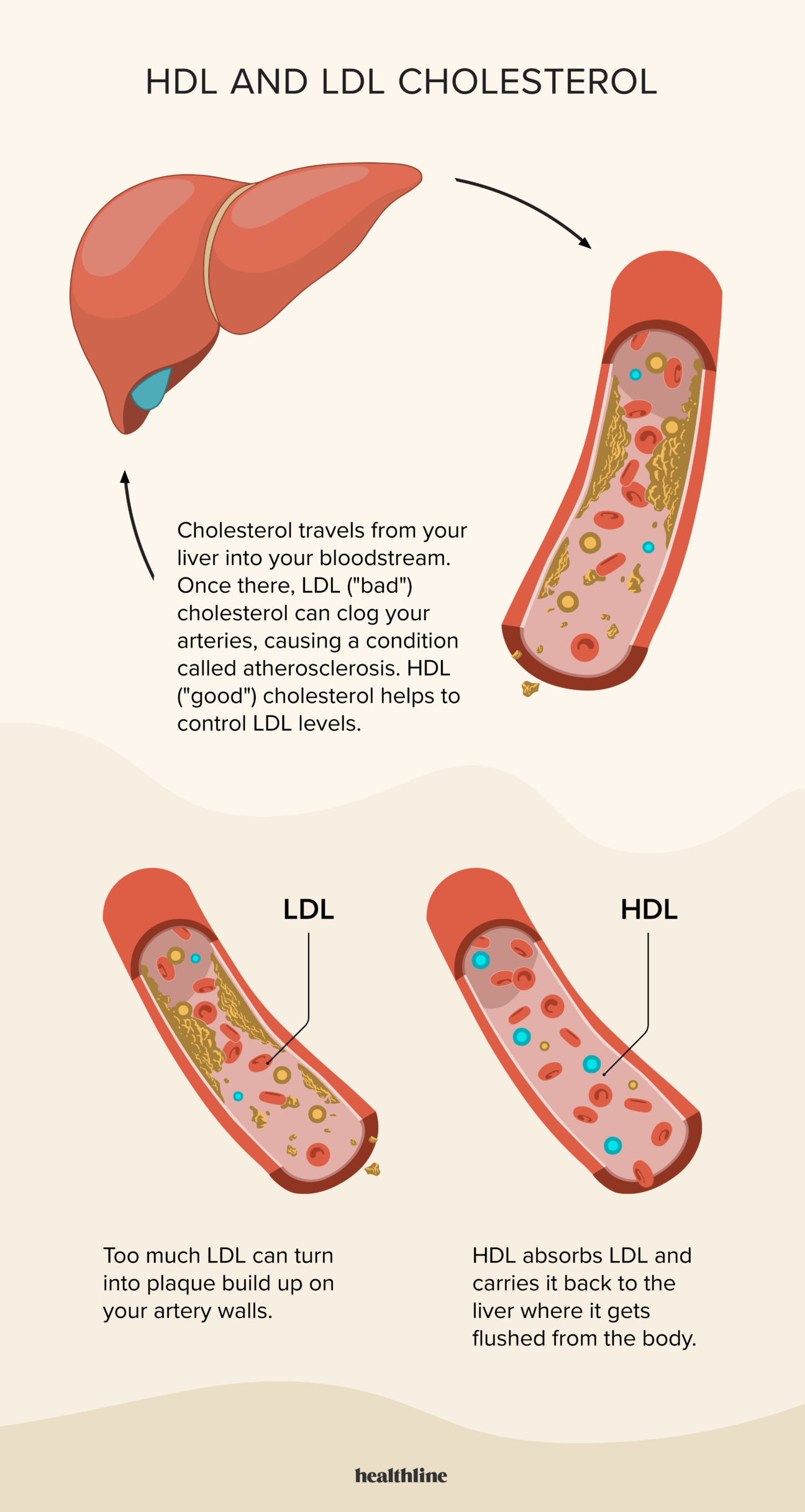 Does protein turn into cholesterol?