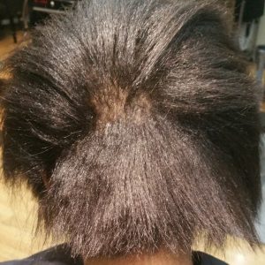 Does relaxer stop hair growth?