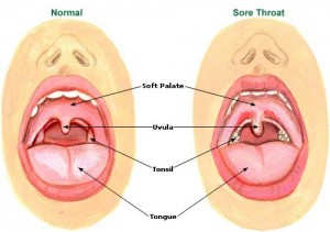 Does salt water irritate a sore throat?