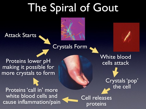 Does soy trigger gout?