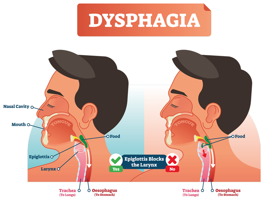 Does thickener cause dehydration?