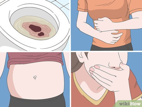 How can I fix constipation fast?