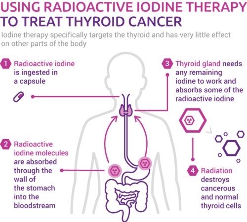 How can I prepare my thyroid for radioactive iodine treatment?