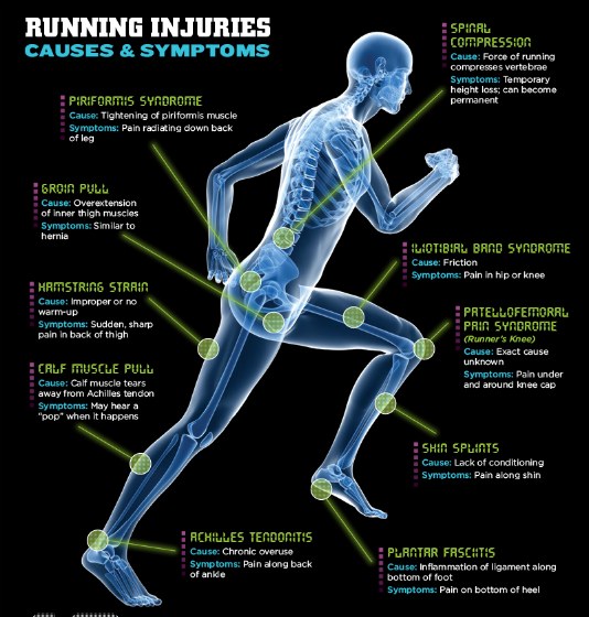 How common are running injuries?